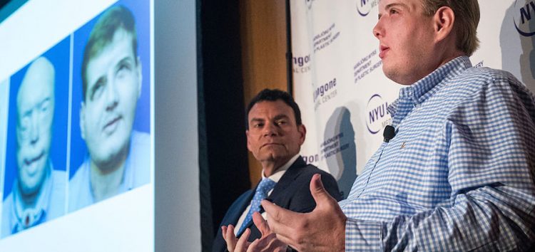 Así Luce Hoy El Hombre Que Recibió El Primer Trasplante De Cara | veobook